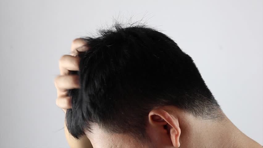 Men Itching Scalp Stock Footage Video (100% Royalty-free) 25386113 ...