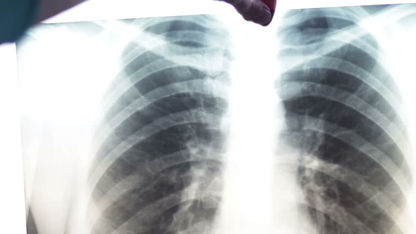 chest x-ray animation breathing beating heart Stock Footage Video (100% ...