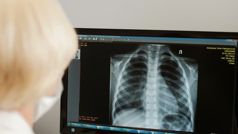 Professional Female Doctor Reading Xray Film Stock Footage Video (100% ...