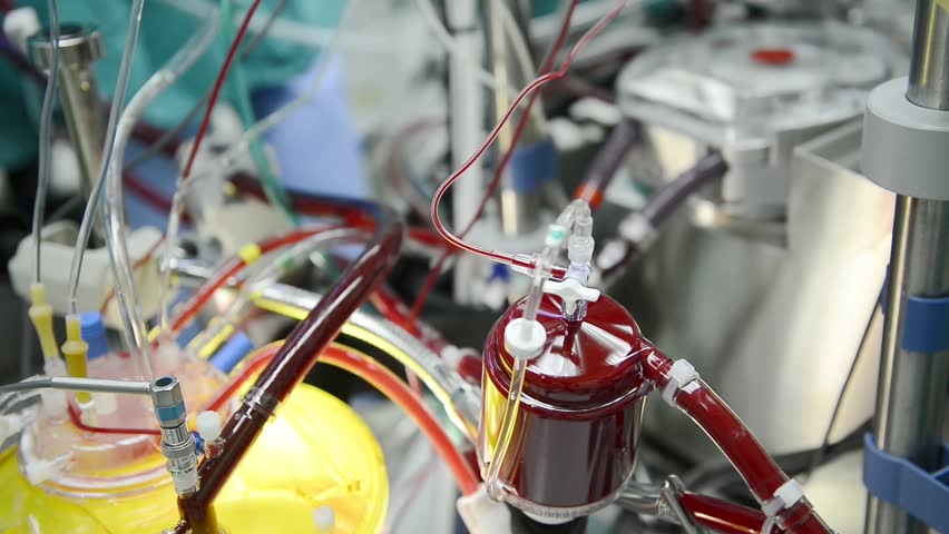 filter heart lung machine during cardiac Stock Footage Video (100% ...