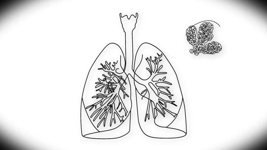Human Lung Structure Animation Illustration Stock Footage Video (100% ...