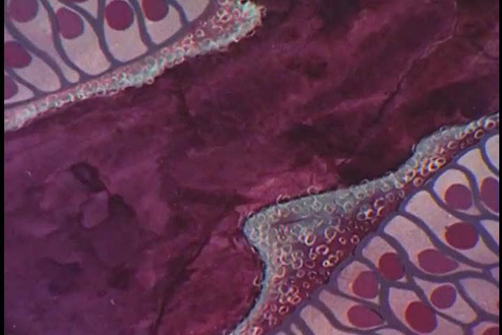 1960s animation used show how syphilis: Stockvideos & Filmmaterial (100 ...