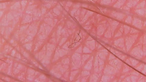 Human skin cells under microscope Stock Video Footage - 4K and HD Video ...