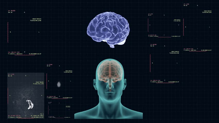 mri human brain different projections high-tech Stock Footage Video ...