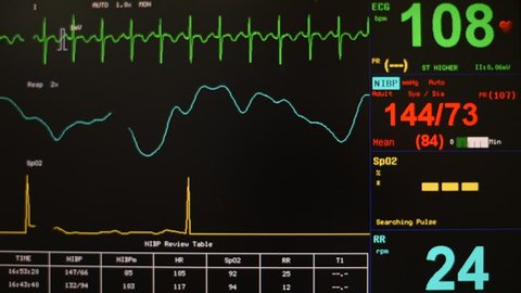 Screen Electrocardiogram Ecg Ekg Device Fake Stock Footage Video (100% ...