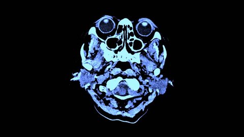 Mexicane Skull Video Animiation Laser Stock Footage Video (100% Royalty ...