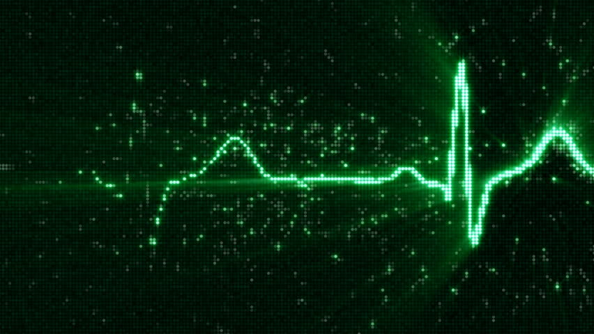 Green Ekg Electrocardiogram Waveform On Screen : vidéo de stock (100 % ...