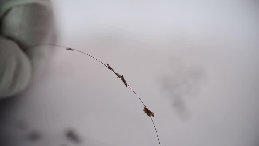 louse head lice feed on blood Stock Footage Video (100% Royalty-free ...