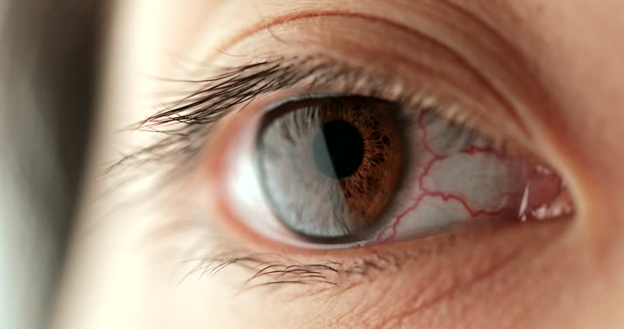 woman red blood eye Stock Footage Video (100% Royalty-free) 30375223 ...
