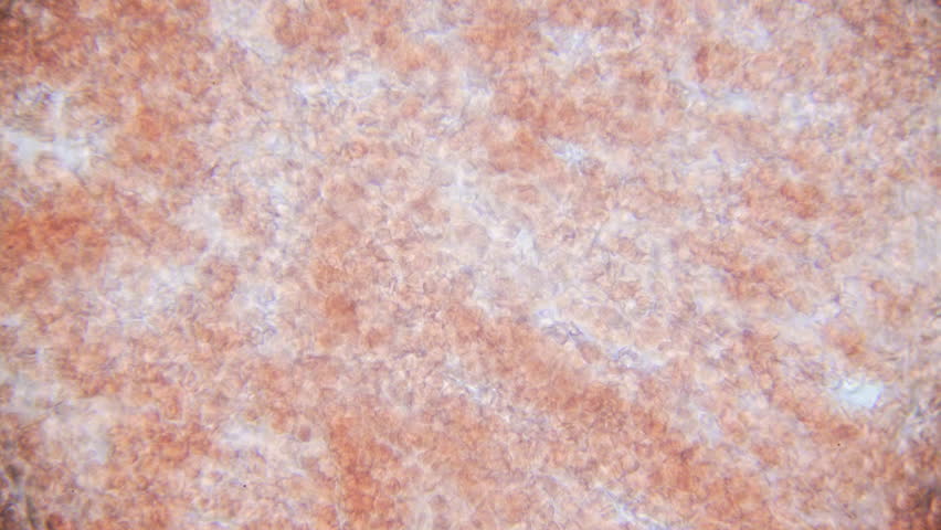 Flowing Red Blood Cells Under Brightfield Stock Footage Video (100% ...