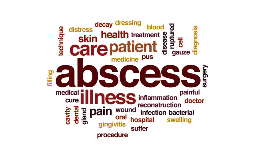 abscess animated word cloud text design Stock Footage Video (100% ...