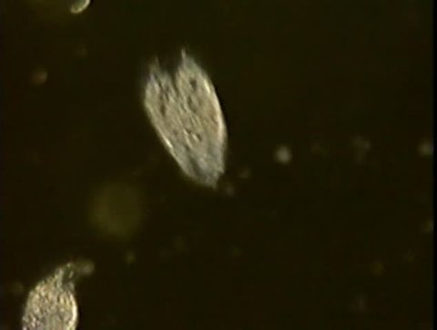 Microscopic Rare Footage Hypotrich Protozoan Tachysoma Stock Footage ...