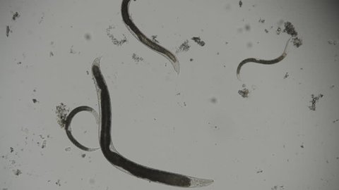 roundworm nematoda turbatrix aceti under microscope Stock Footage Video ...