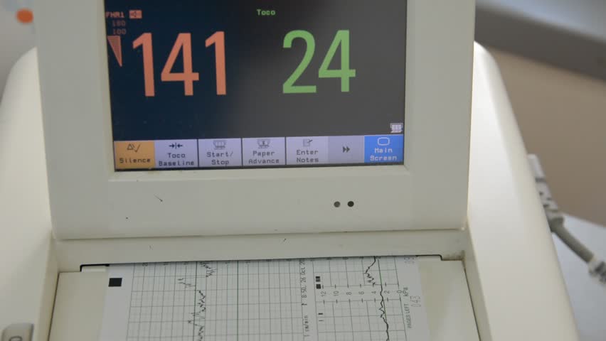 Electronic Fetal Monitor (efm) or Stock Footage Video (100% Royalty ...