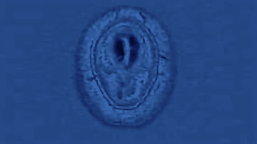 Brain scan visualization footage. The device scans and displays vital ...