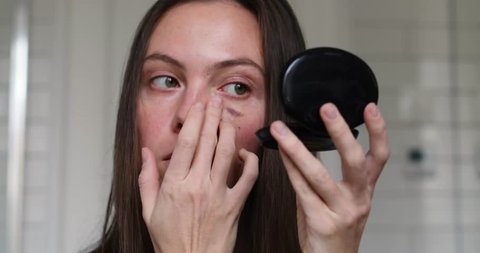 Woman Looking Mirror Bruise Eye Closeup Stock Footage Video (100% ...