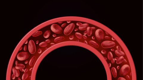 Hemophilia Damaged Blood Vessel Haemophilia Coagulation Stock Vector (Royalty Free) 1373866421