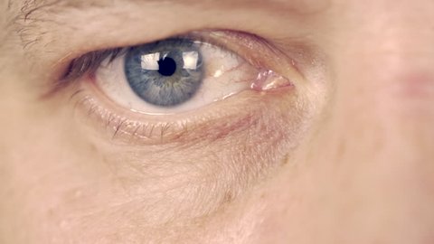 Milia Milium Pimples Around Eye On Stock Photo 401008504 | Shutterstock
