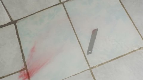 64 Wrist Bleeding Stock Video Footage - 4K and HD Video Clips ...