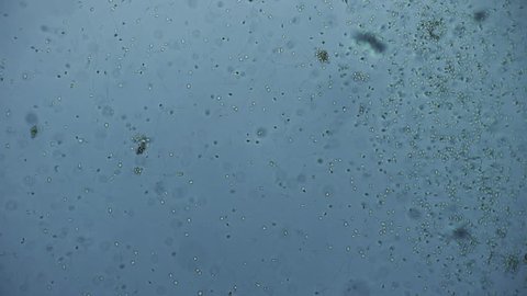 Large Colony Protozoa Moves Under Microscope Stock Footage Video (100% ...