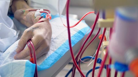 Dialysis Stock Video Footage - 4K and HD Video Clips | Shutterstock