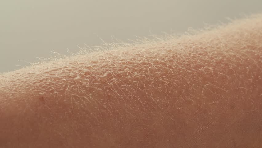 Goosebumps Stock Footage ~ Royalty Free Stock Videos | Pond5