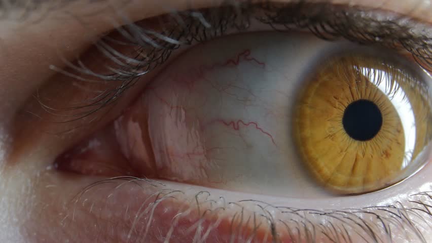 Bulging Eye Stock Video Footage - 4K and HD Video Clips | Shutterstock