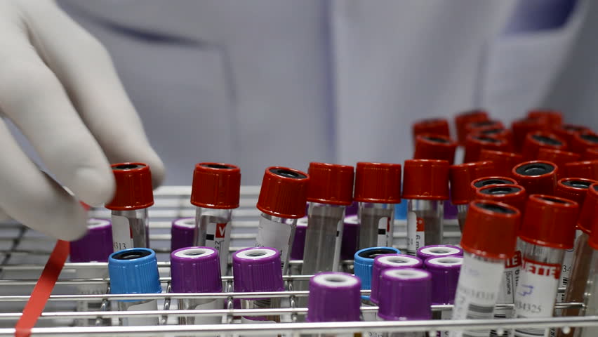 production line tablet pill sorting packaging Stock Footage Video (100% ...