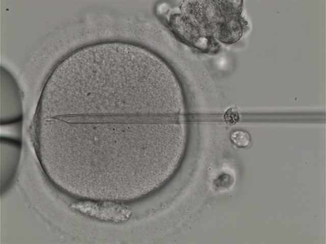 Embryo Implantation Stock Video Footage | Royalty Free Embryo ...