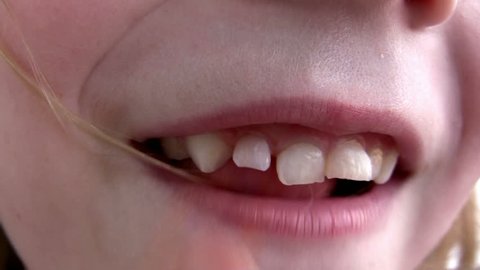 Child Wiggling Loose Tooth Stock Footage Video (100% Royalty-free ...