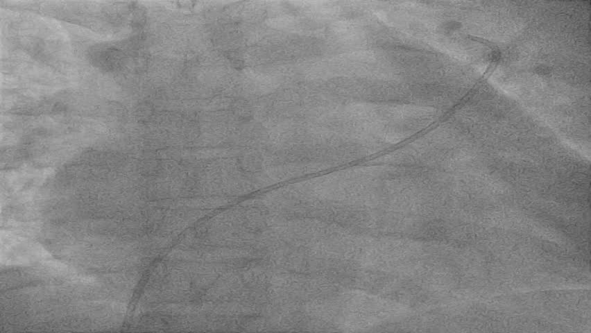 235 Cardiac Mri Videos