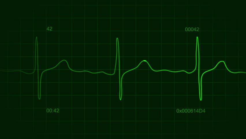 heart rate monitor animation Stock Footage Video (100% Royalty-free ...