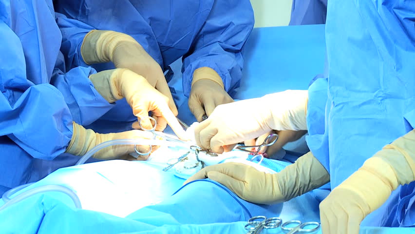 Senior Doctor Performing Operation Using Stock Footage Video (100% ...