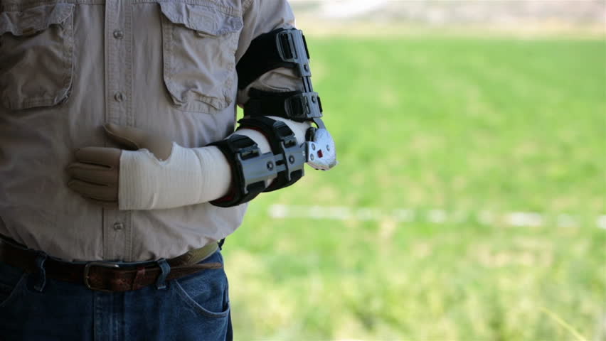 medical man arm brace after surgery Stock Footage Video (100% Royalty ...