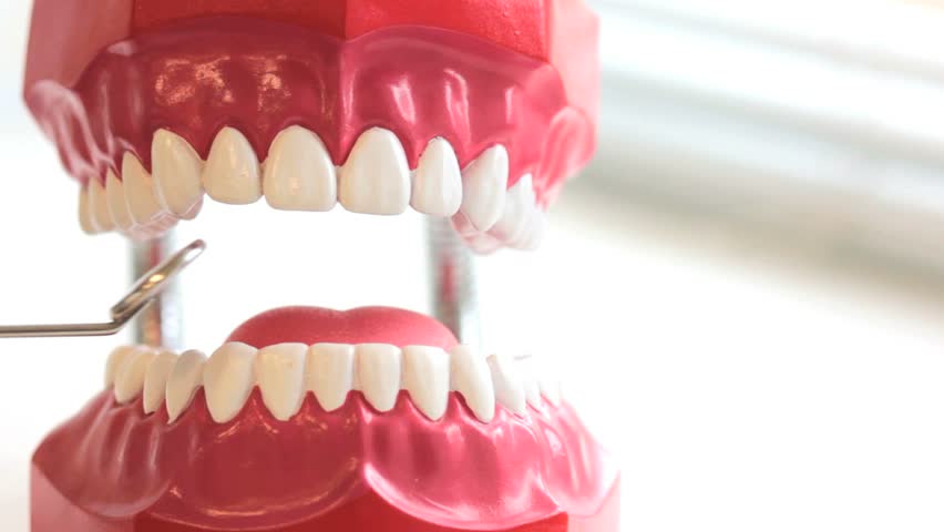 replacement process maxillary canine dental implant Stock Footage Video ...