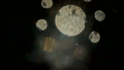 Multifaceted Lens Flare Full Lens Detail Stock Footage Video (100% ...