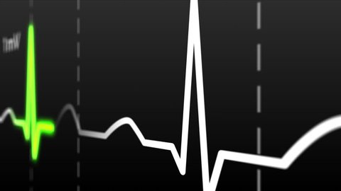 Animation Schematic Intensive Care Unit Monitor Stock Footage Video ...