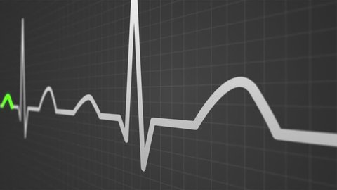 Animation Schematic Diagram Normal Sinus Rhythm Stock Footage Video ...