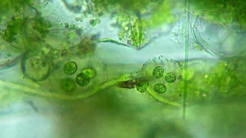 Seaweed Algae Vaucheria Under Microscope Magnification Stock Footage ...