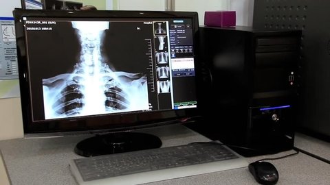 Xray Anatomy Monitor Xray Image Diagnostic Stock Footage Video (100% ...