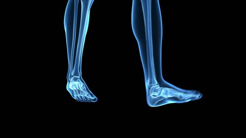 Xray Knee Showing Bone Stump After Stock Photo (Edit Now) 1509386000