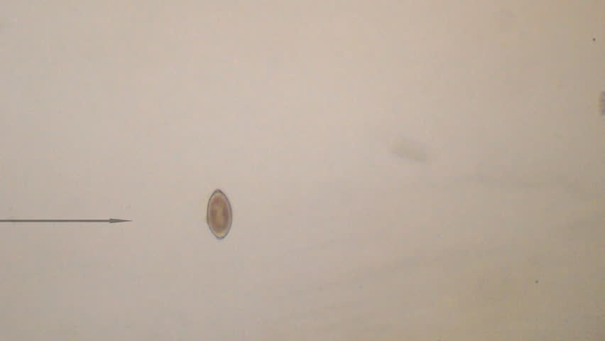 parasitic whipworm trichuris vulpis egg under: Stockvideos ...