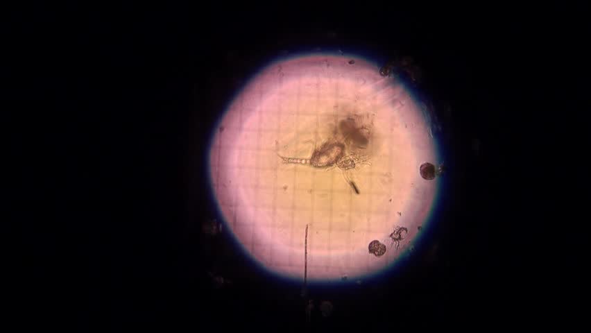 The Copepod Calanus Finmarchicus, Under Stock Footage Video (100% ...