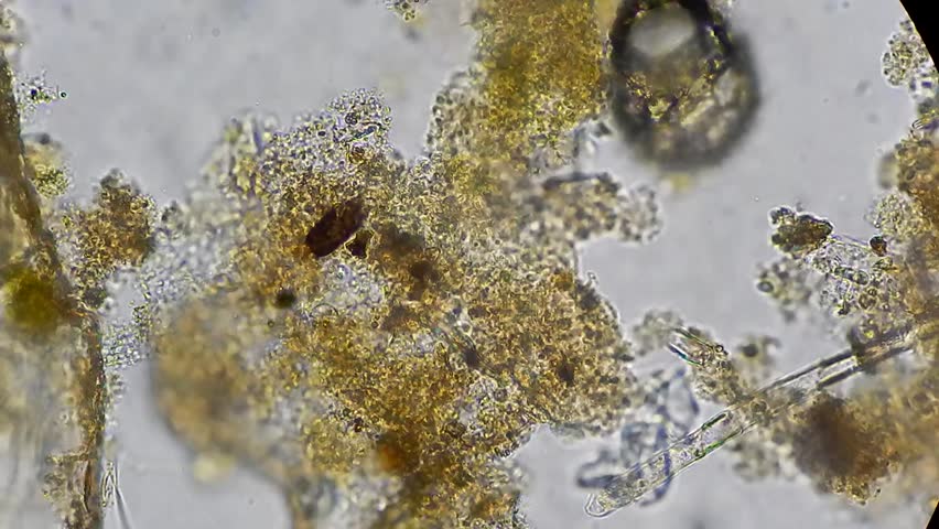 bacteria feeding under microscope 600x Stock Footage Video (100% ...