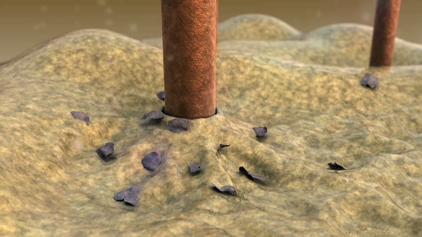 Hair, Dandruff, Skin Under Microscope, Stock Footage Video (100% ...