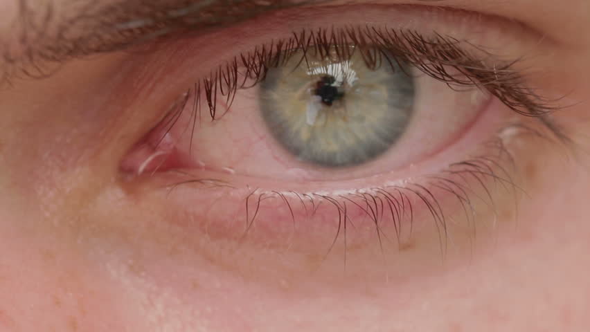 opening closing one eye young man Stock Footage Video (100% Royalty ...