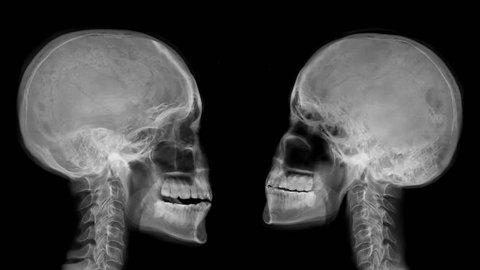 Two Arguing Skulls Loop Animation Stock Footage Video (100% Royalty ...
