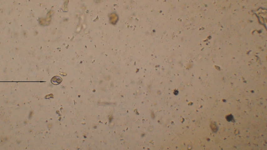 veterinarian looking coccidia isospora felis oocyst: วิดีโอสต็อก (ปลอด ...