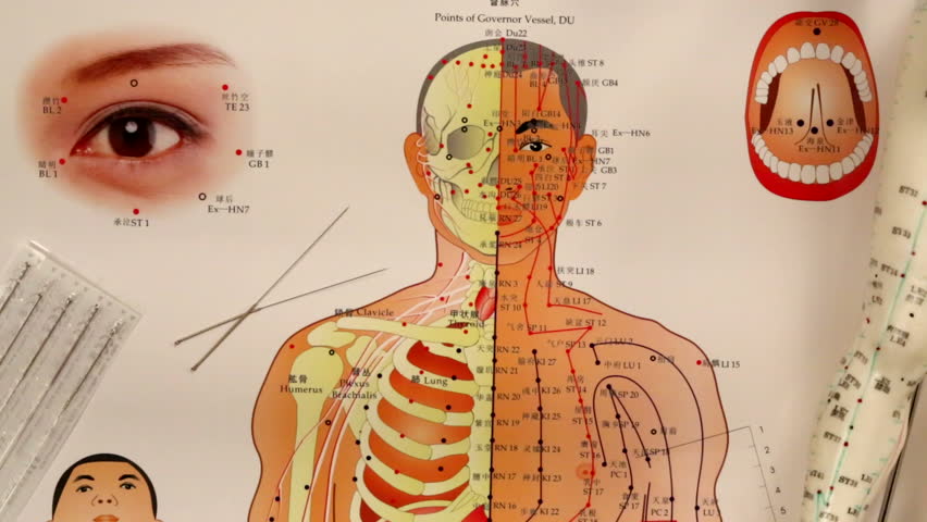 Chinese Medicine - Acupuncture is Stock Footage Video (100% Royalty ...