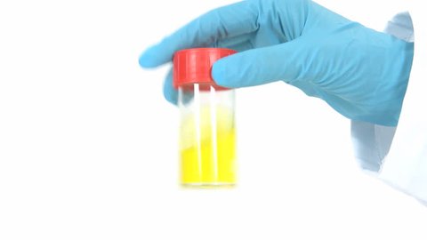 Marine Plankton Microalgae Culture Into Test Stock Photo 1639093183 ...